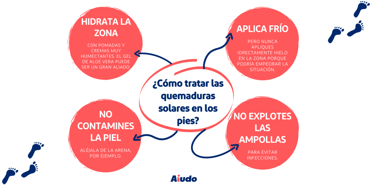 Trata y evita las quemaduras solares en los pies - Aiudo Servicios